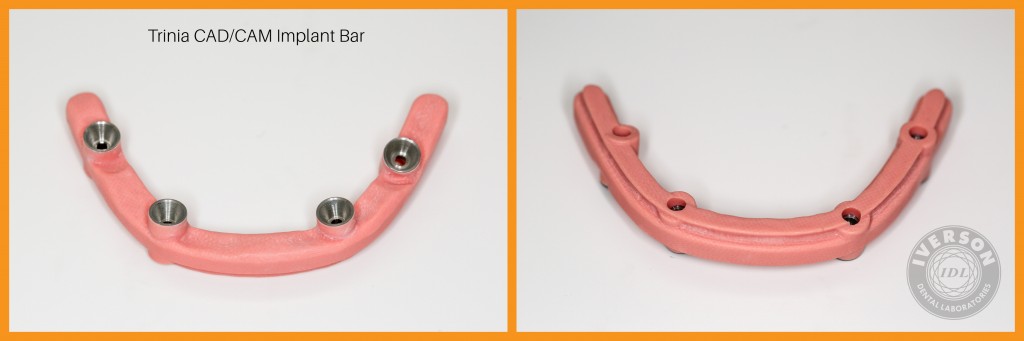 Trinia-Metal-free Implant Bars and Abutments