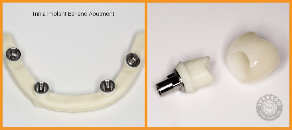 Trinia-Metal-free Implant Bars and Abutments