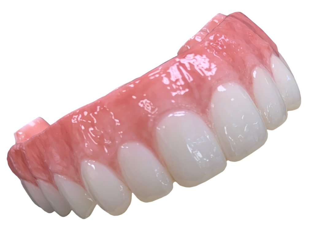 Digital Dental Implants Laboratory in USA: Iverson Dental Labs