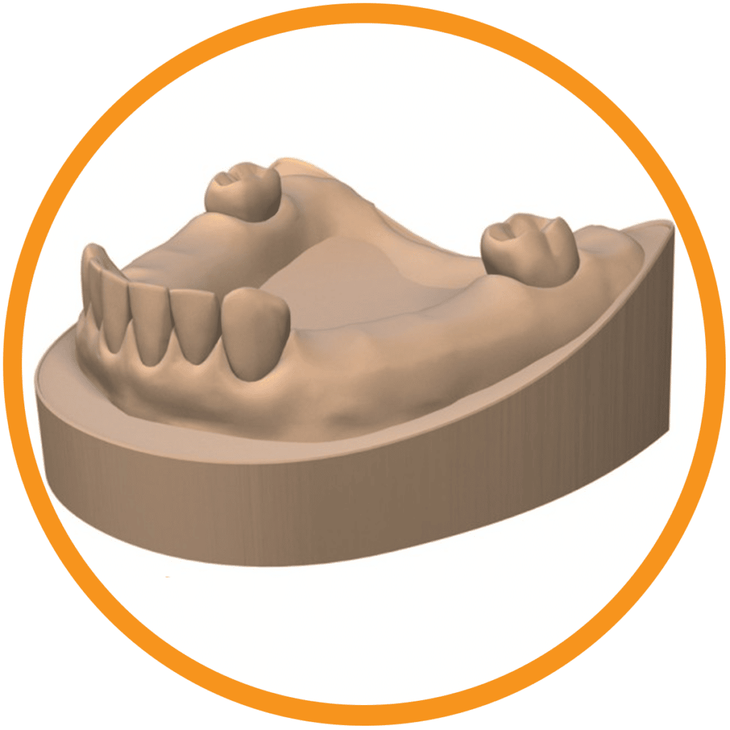 Accuguide - surgical guide for dental implant placement